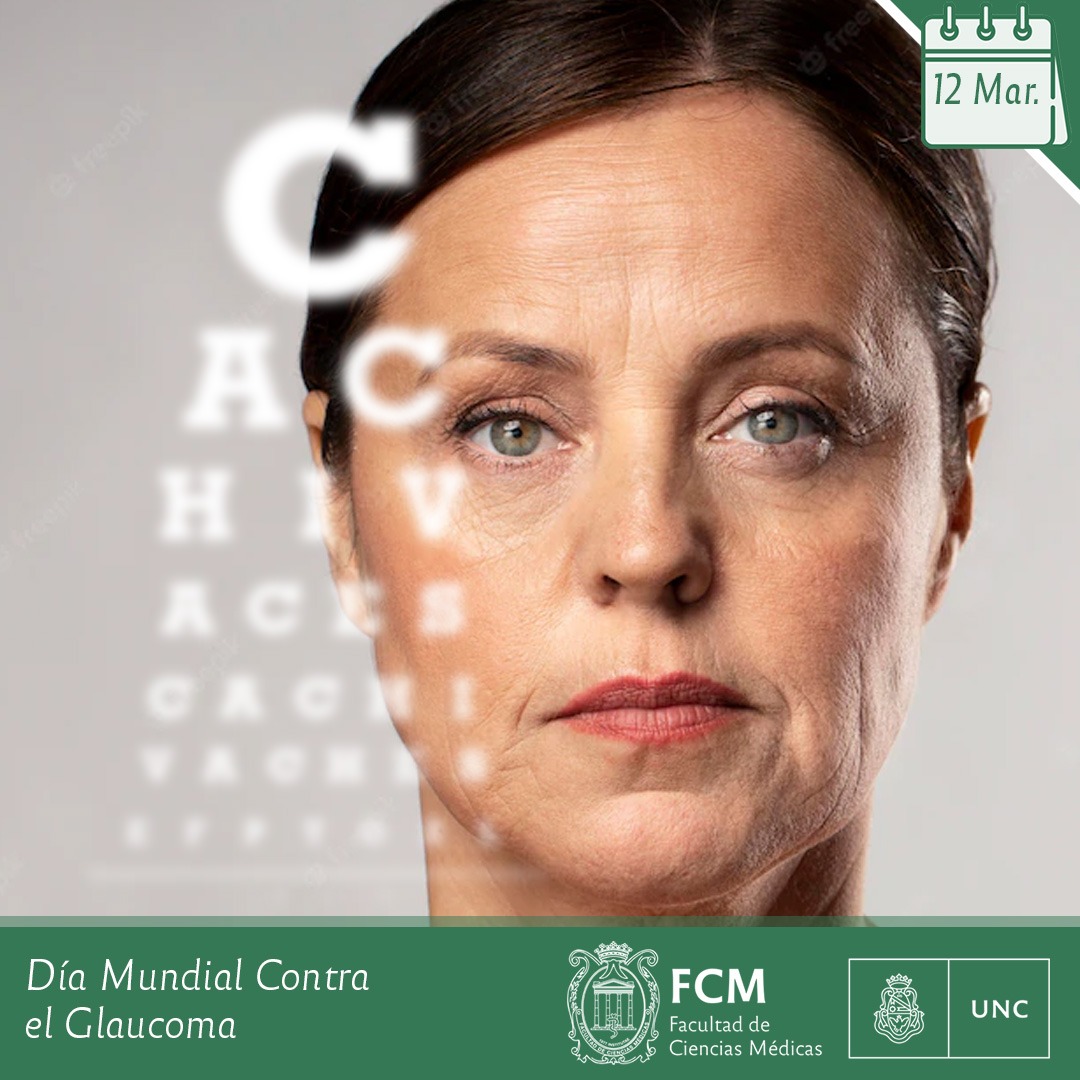 12 De Marzo “día Mundial Contra El Glaucoma” Facultad De Ciencias